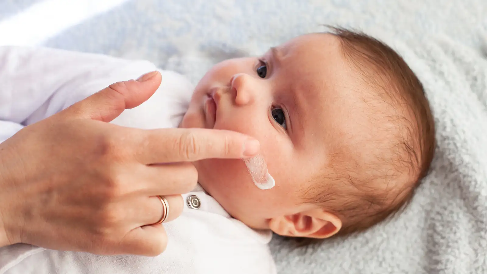 Baby Acne vs Skin Rash: Causes, Symptoms and Care Tips