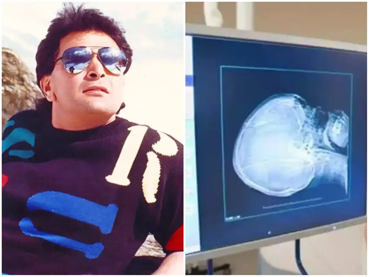 Raththa Putrunoi Treatment,எலும்பு மஜ்ஜை மாற்று சிகிச்சைனா என்ன? ரிஷி ...