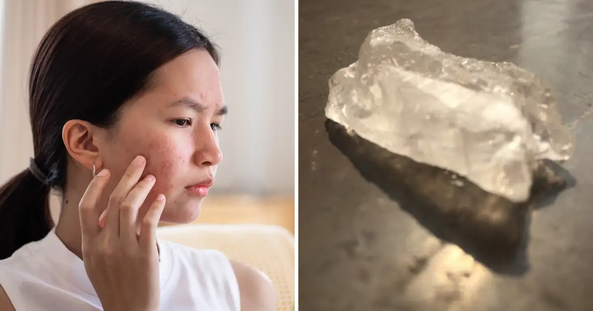 How To Make Alum Face Pack,नहीं है तो पंसारी से खरीद लो! 5 रु के पत्थर ...