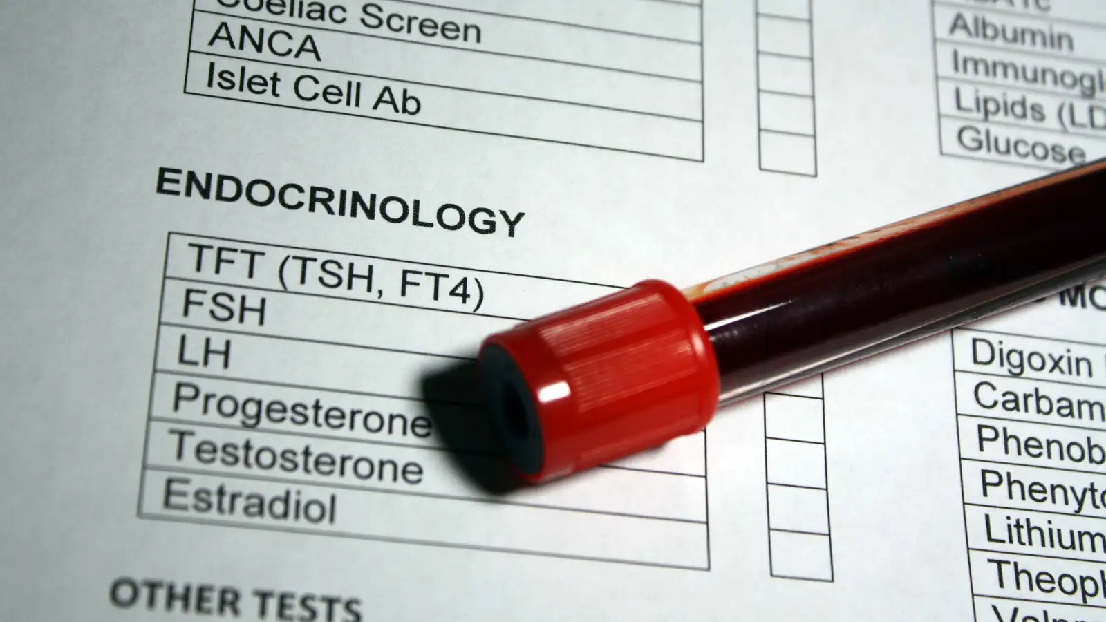Understanding Progesterone’s Role in Pregnancy: From Conception to Birth