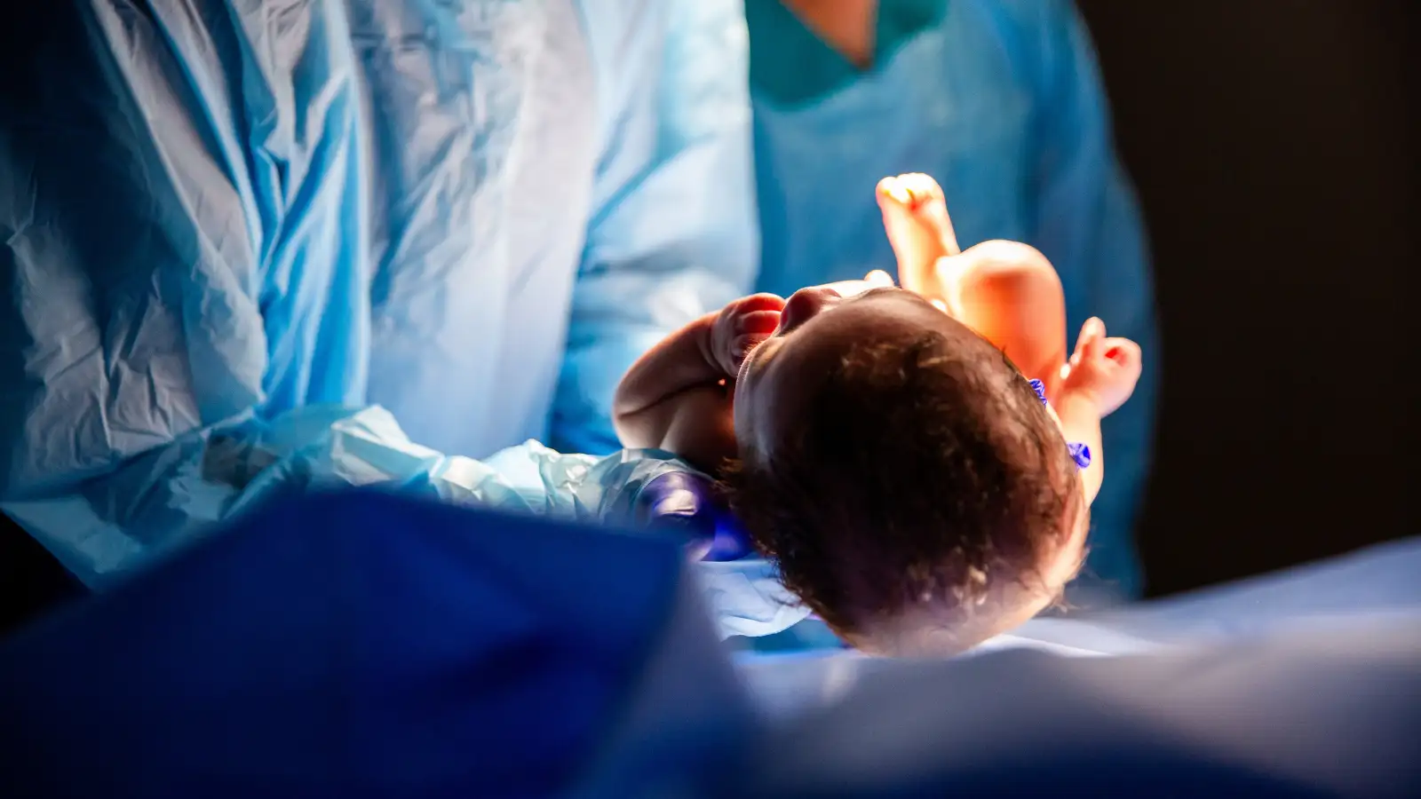 Forceps Marks on Newborns: How Long They Last and When to Worry