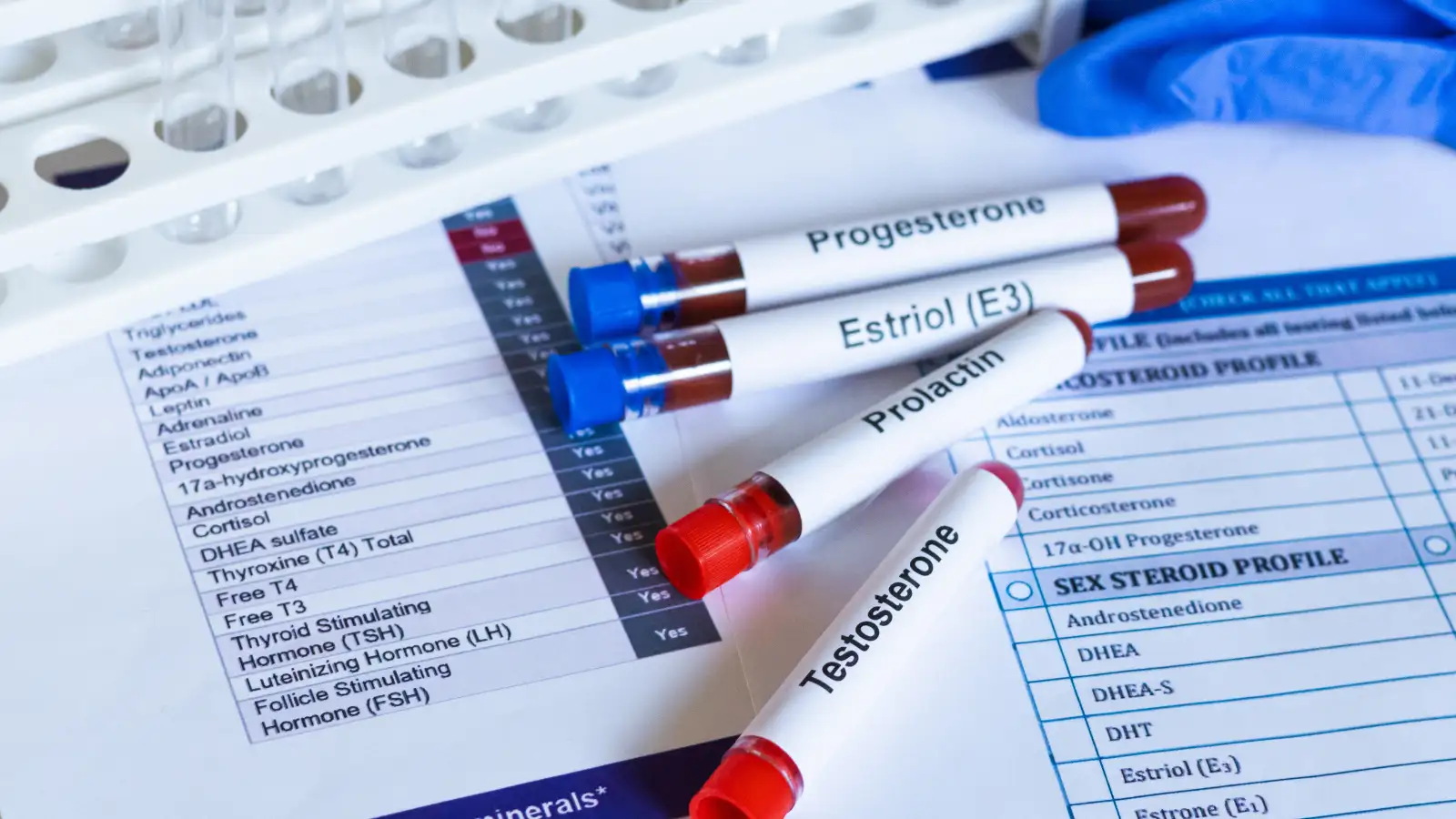 How Prolactin Helps the Uterus Sustain a Healthy Pregnancy