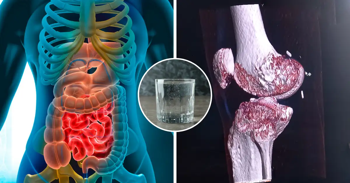 Fluoride In Drinking Water Side Effects, पीने से पहले पानी से हटा लें ...