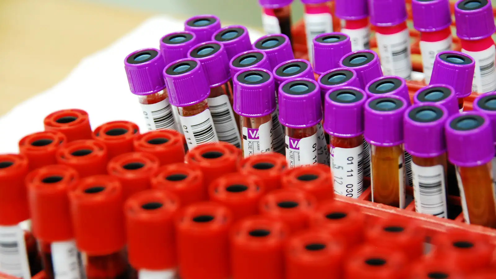 The A-Z of Blood Tests Needed in Every Pregnancy Trimester