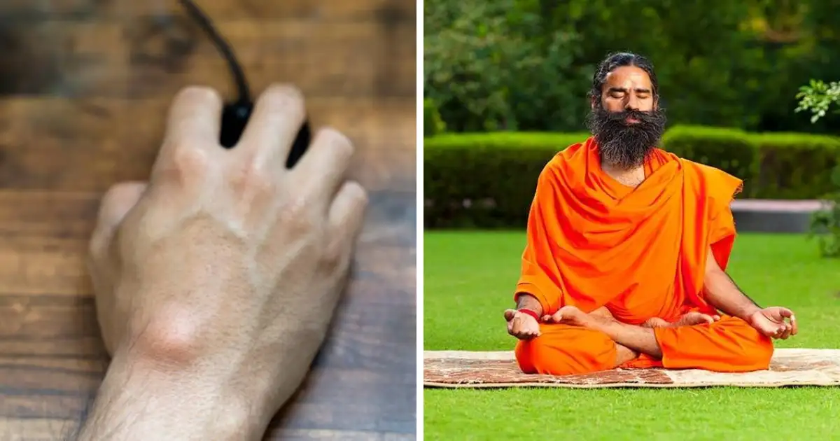 Ramdev Baba Shared Ayurvedic Remedies For Fat, TB, Cancer, Tumor Lumps ...