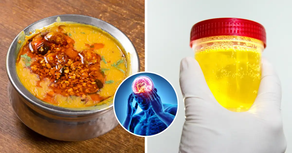 Toor Dal Adulteration Test,'ये दाल खाने से ब्रेन हुआ डैमेज', पेशाब में ...