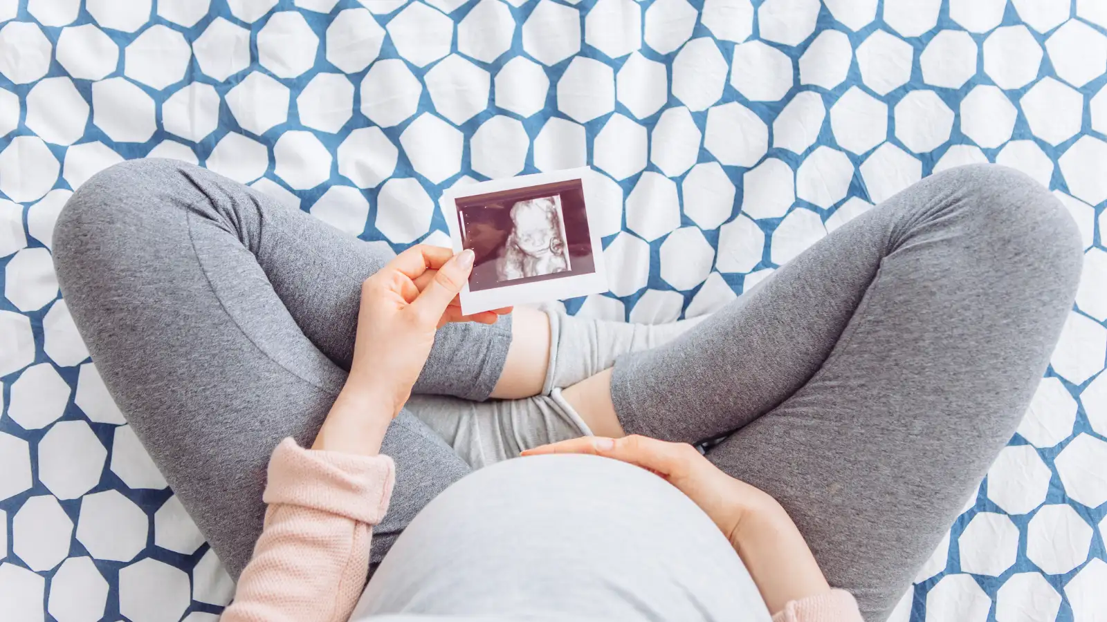 Fundal Height vs Baby Growth Scan: Why Both Matter