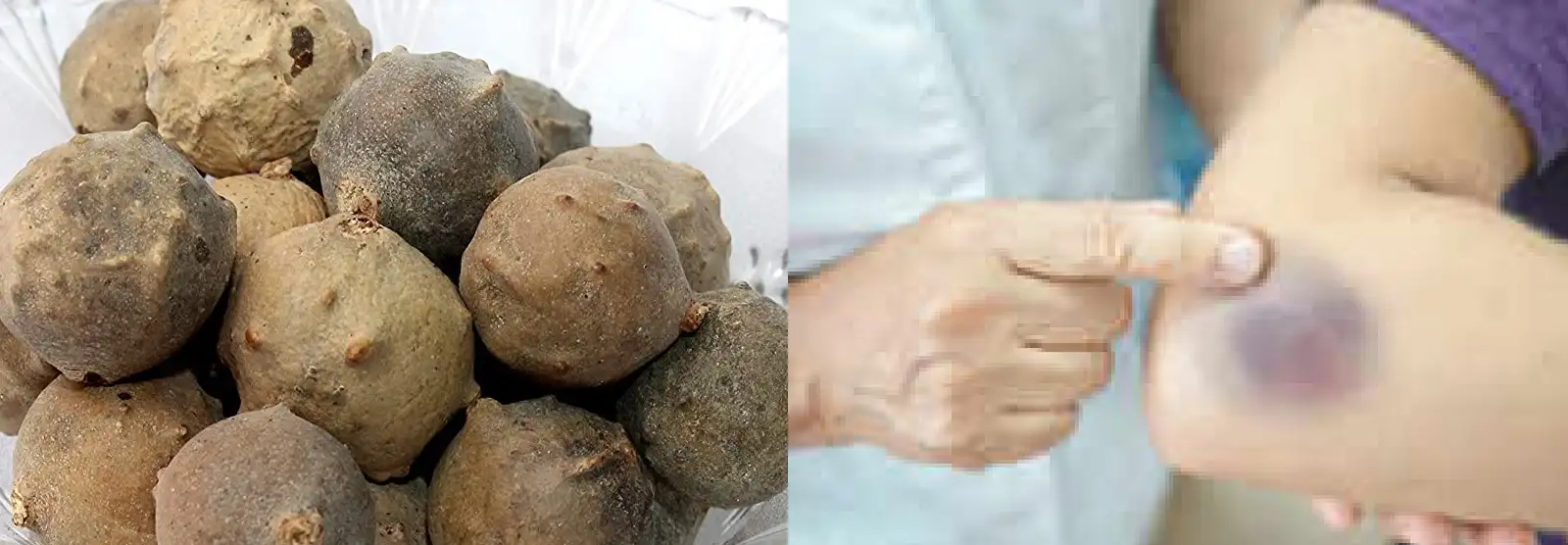 Masikai Health Benefits,சர்க்கரை நோயாளியின் புண்ணை முழுமையாக ...