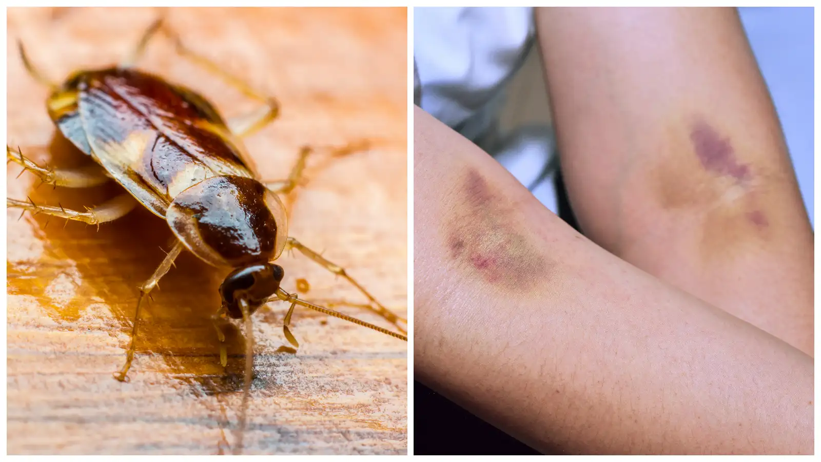 ನಾವು ರಾತ್ರಿ ಮಲಗಿದ ಸಂದರ್ಭದಲ್ಲಿ ಜಿರಳೆಗಳು ಕೂಡ ಕಚ್ಚುತ್ತವೆಯಂತೆ! ಲಕ್ಷಣಗಳು ...