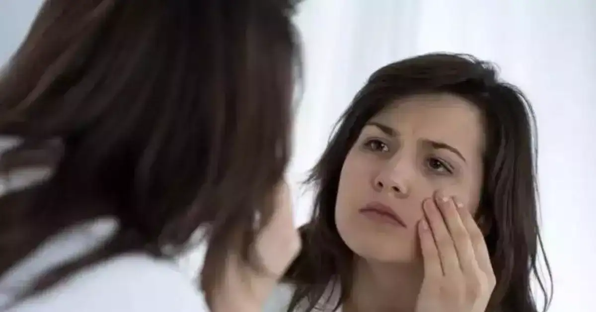 Skin Problems After Pregnancy,ಹೆರಿಗೆಯ ಬಳಿಕ ಚರ್ಮದಲ್ಲಿ ಯಾವೆಲ್ಲಾ ...