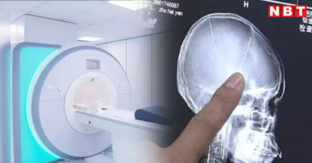 Needle Brain Woman: Needle Found In 80 Year Old Russian Woman Brain ...