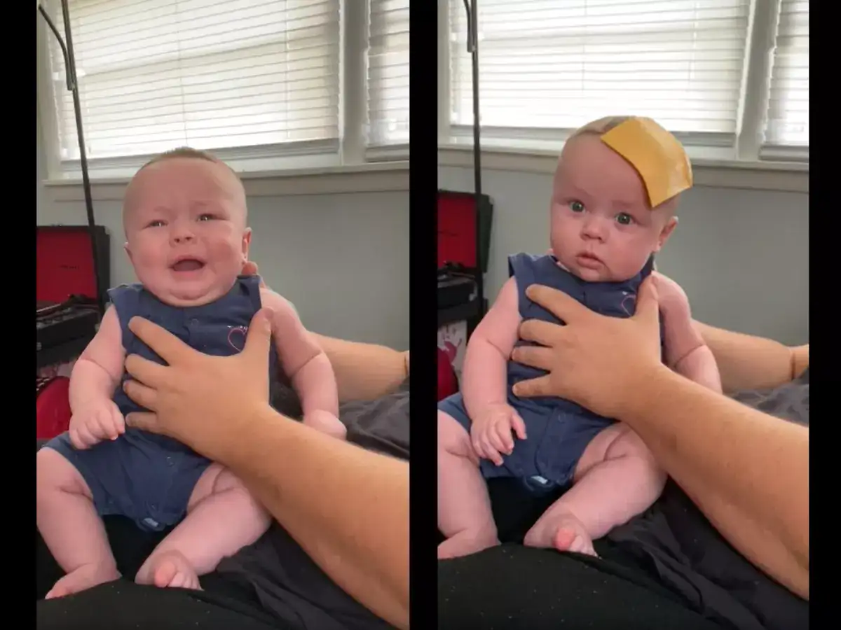 Cheese On Baby's Head,ഒന്ന് കരഞ്ഞു എന്നല്ലേയുള്ളൂ! അതിന് ഇങ്ങനെ ...