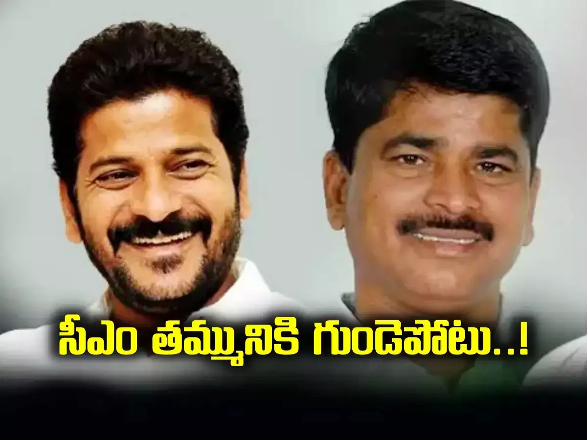 Revanth Reddy Brother Heart Attack,సీఎం రేవంత్ రెడ్డి సోదరుడు తిరుపతి ...