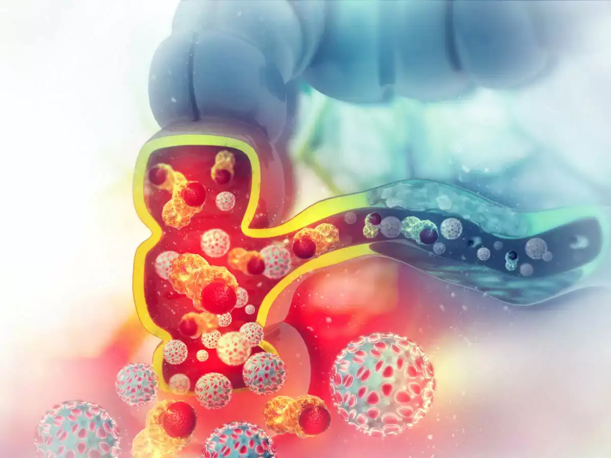 Kudal Putrunoi Arikurigal,குடல் புற்றுநோய் பற்றி தெரிந்துகொள்ள வேண்டிய ...