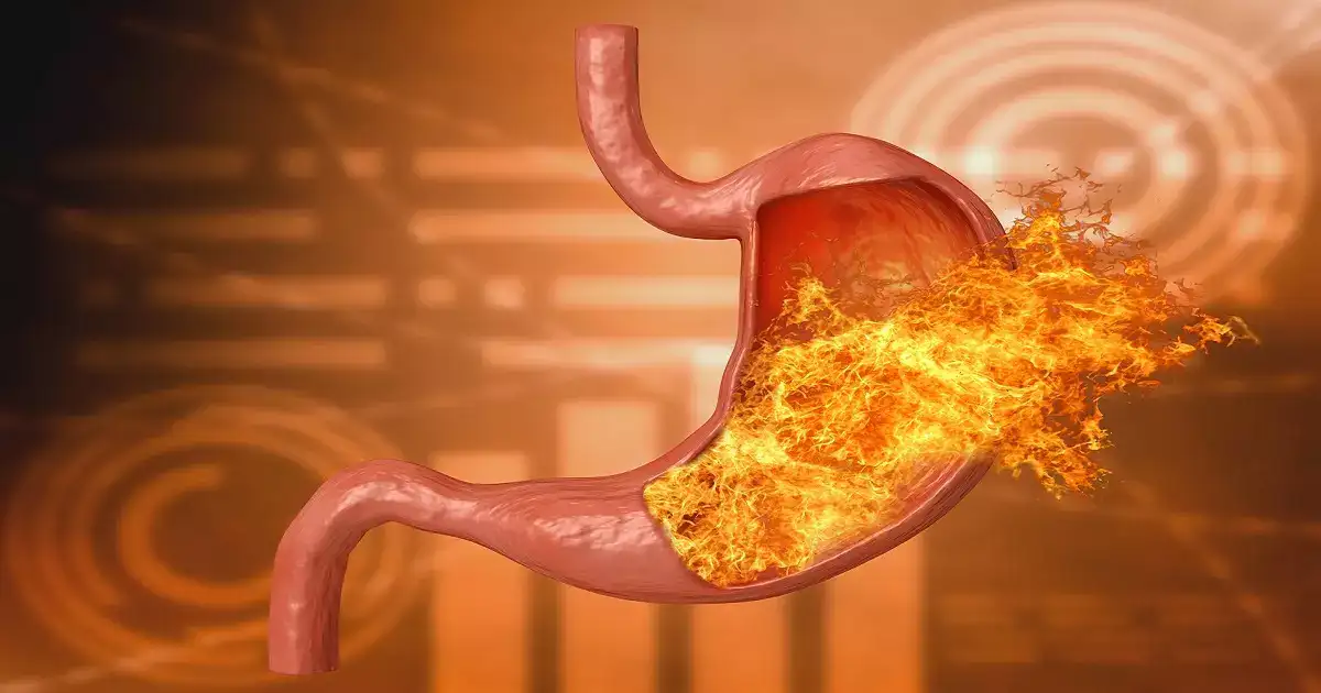 Stomach ulcers: కడుపులో అల్సర్స్‌‌‌‌‌‌ తగ్గాలంటే.. ఈ ఆహారం తింటే మంచిది ...