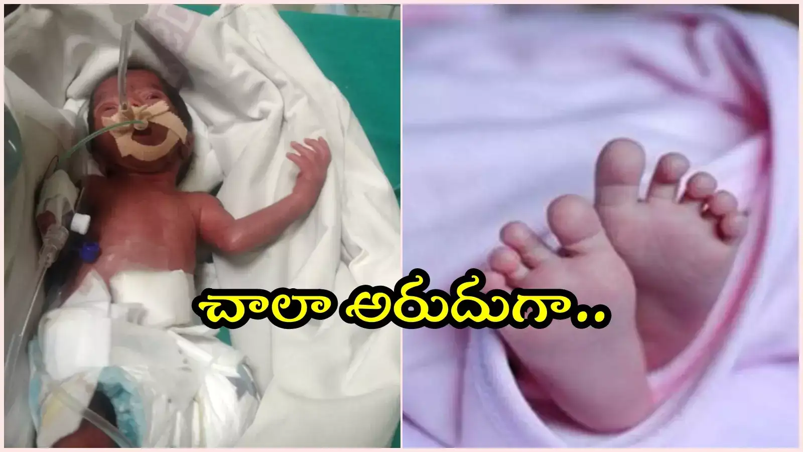 Kgh Hospital Baby,విశాఖ కేజీహెచ్‌లో మిరాకిల్ శిశువు.. ఆ తండ్రి ...