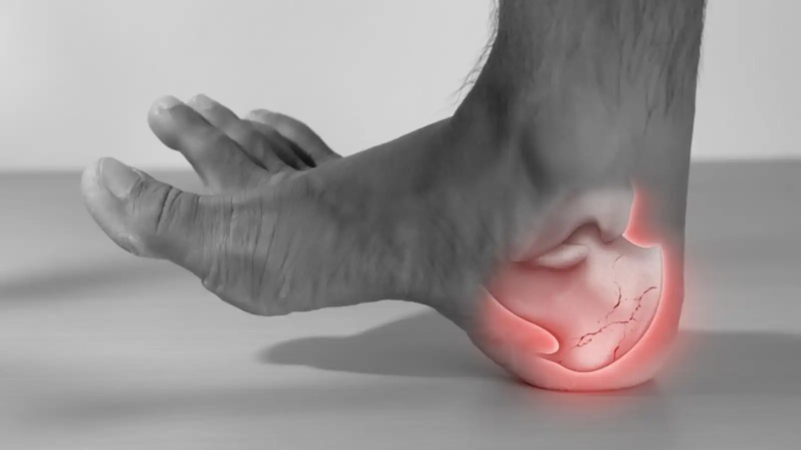 Bone Spurs: Bone Growth Is Harmful In Old Age, Know The Symptoms Of ...