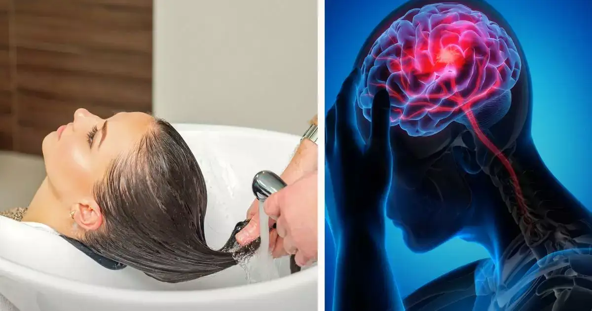 Hyderabad 50 Years Old Woman Shows Symptoms Of Beauty Parlour Stroke ...