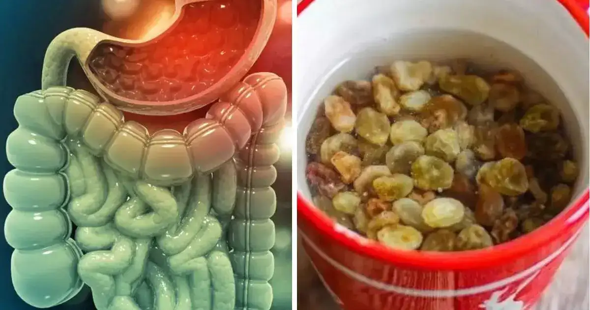 Foods For Piles Constipation Anal Fissure,Anal Fissure Treatment: पोट ...