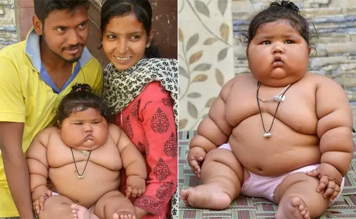Chahat Kumar 17 கிலோ எடை குழந்தை,17 கிலோ எடையுடன் 8 மாத குழந்தை ...