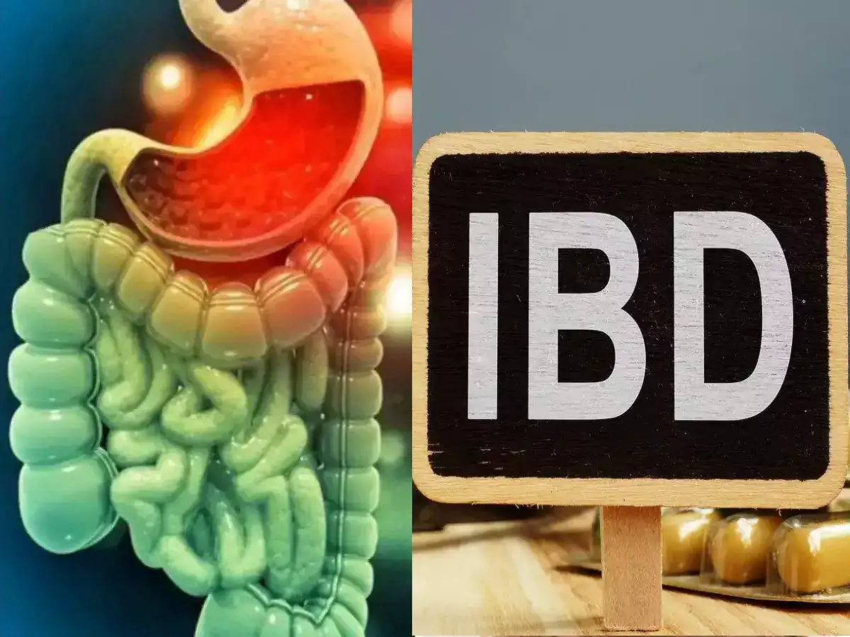 IBS vs IBD : அழற்சி குடல் நோய், எரிச்சல் கொண்ட குடல் நோய்க்குறி ...