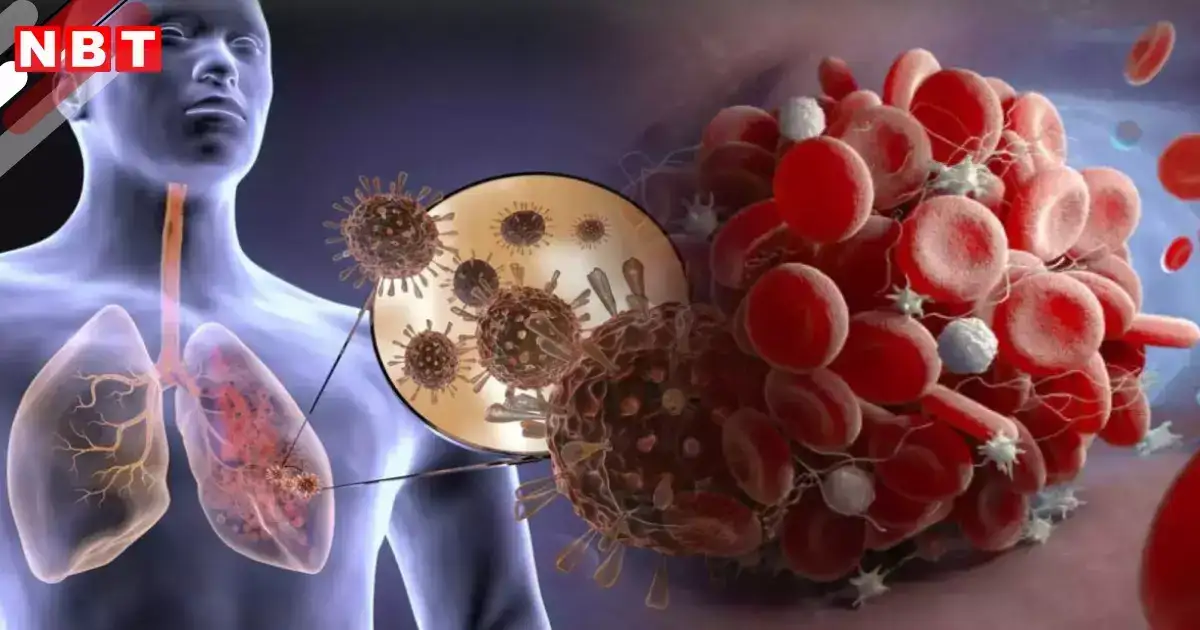 Covishield Vaccine Side Effect TTS: Astrazeneca Covishield Vaccine Side ...