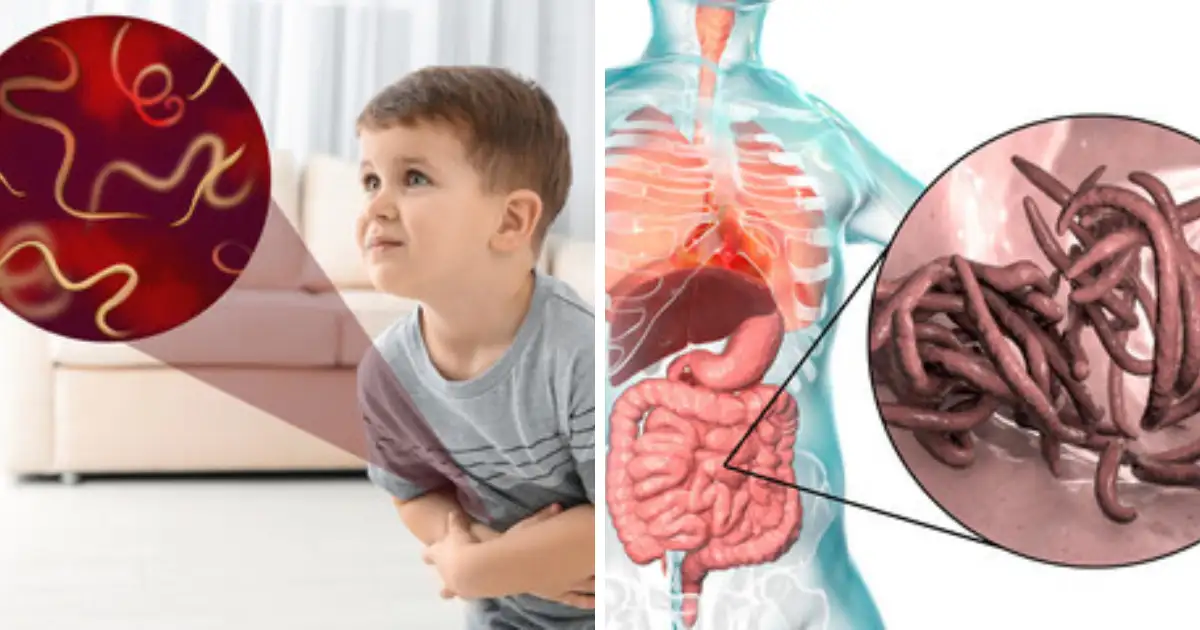 identify worm infection in children early diagnosis is important says ...