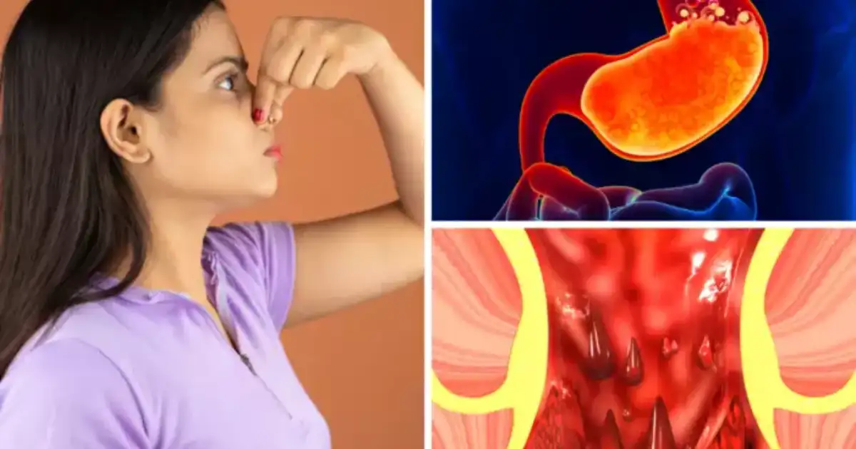 Different Fart Smells Meaning Gas Releasing Benefits and Excessive ...