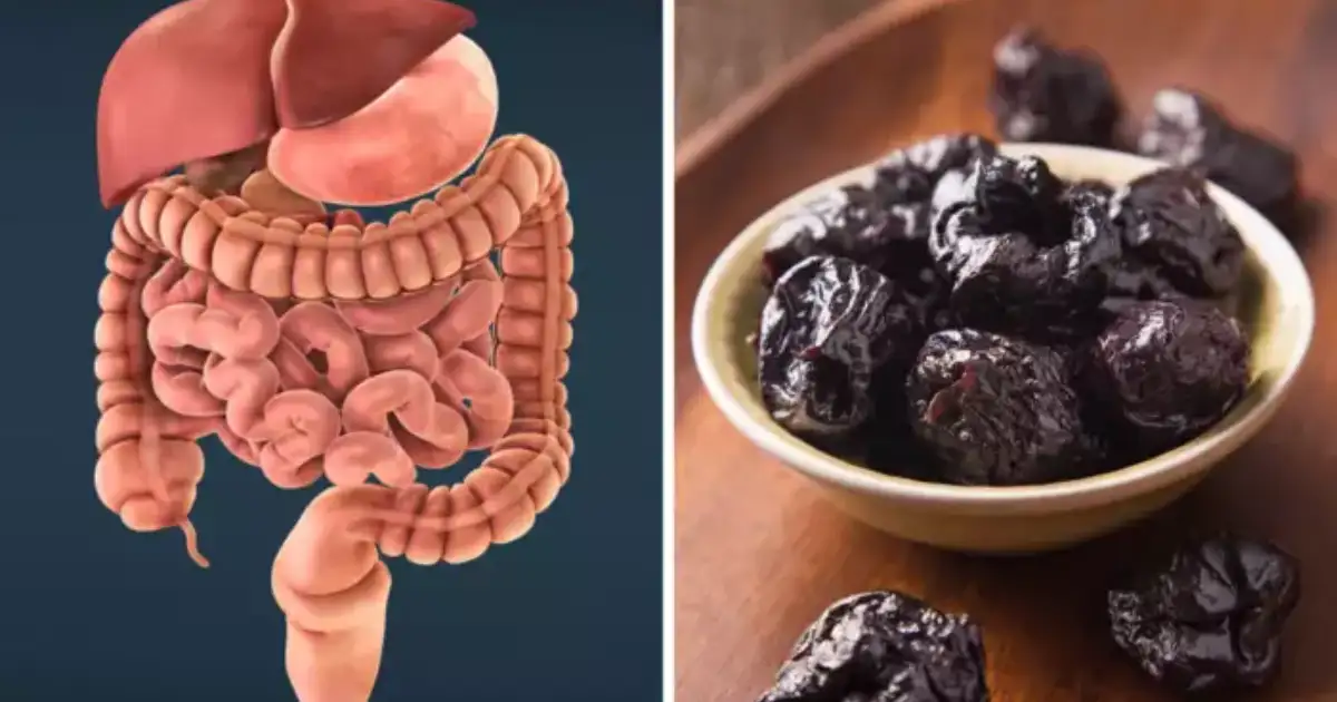 According Food Science And Nutrition Dried Plum Can Reduce Constipation ...
