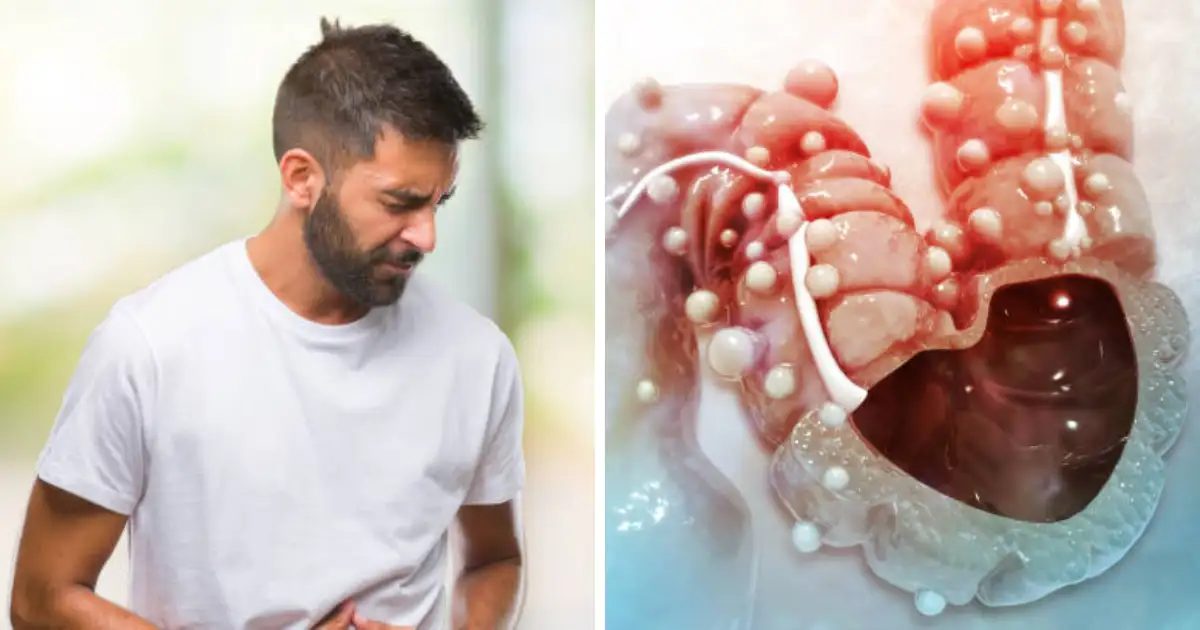 blood in stool constipations stomach issue are the symptoms of colon ...