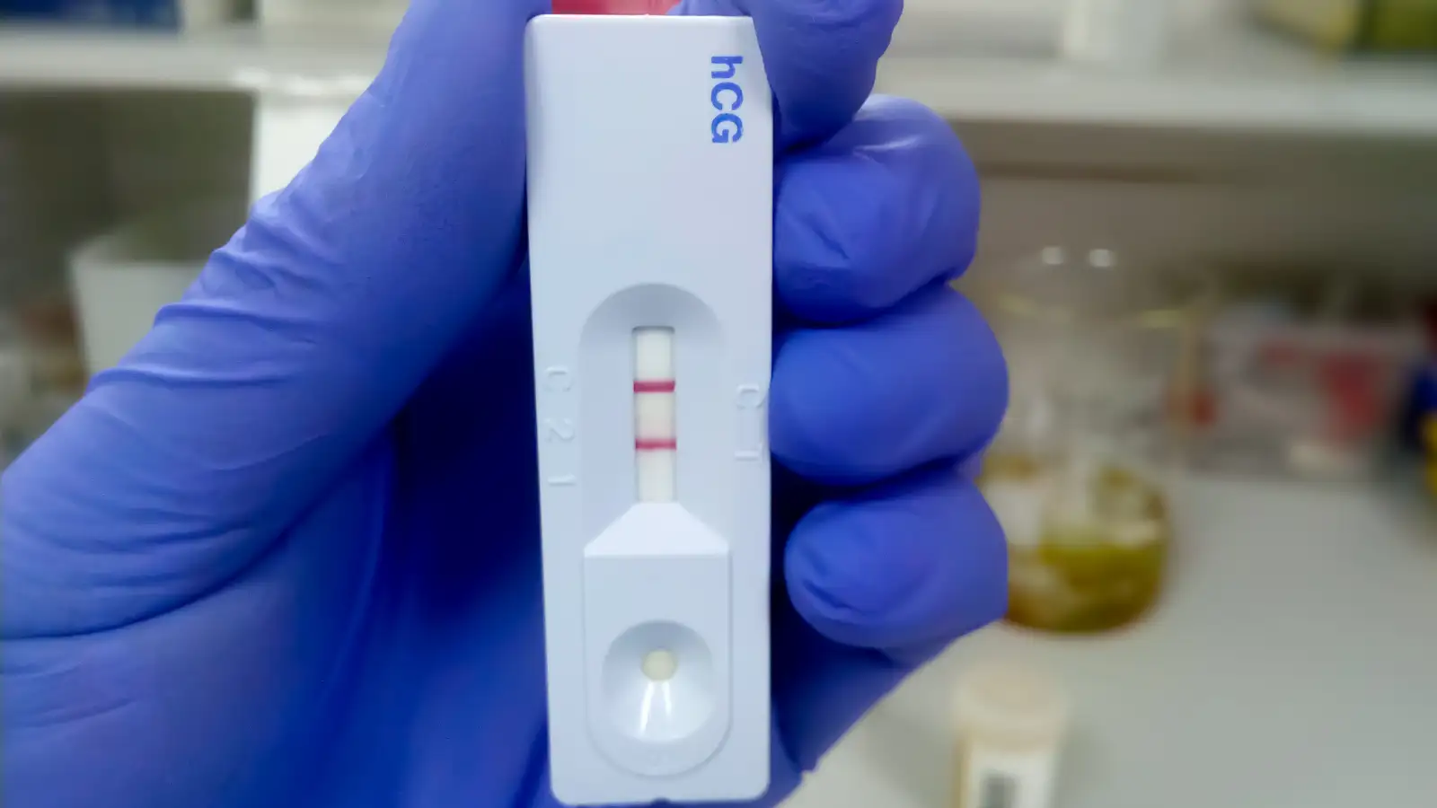 hCG Levels Week 4: What’s Normal and What’s Not