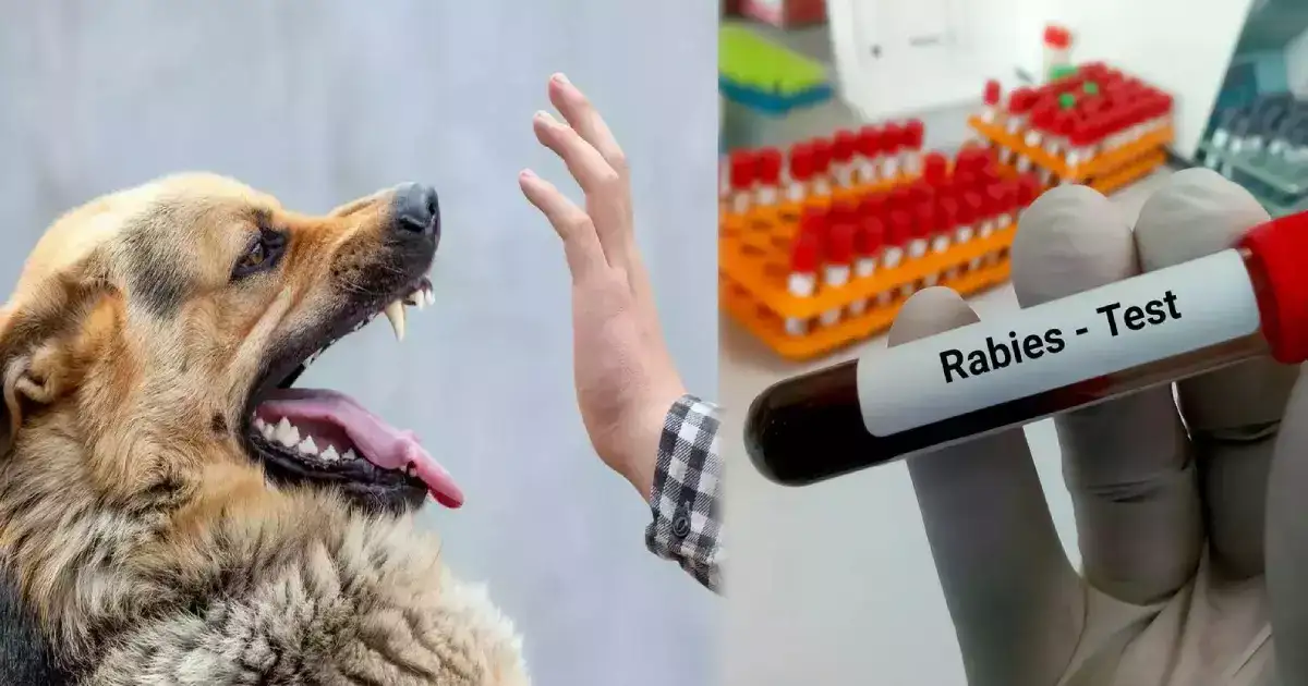 Rabies Prevention Tips,പേവിഷബാധ മരണങ്ങൾ തുടരുന്നു; മൃഗങ്ങളുടെ കടിയേറ്റാ ...