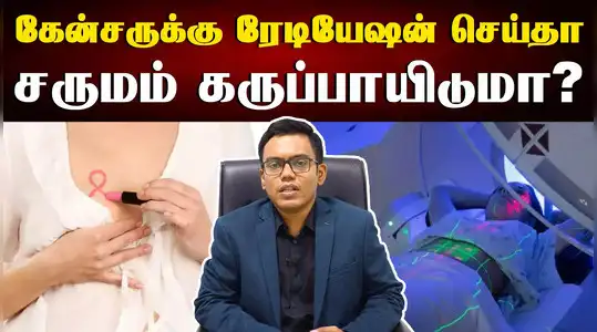 ரேடியேஷன் சிகிச்சை செய்தால் உடல் பலவீனமாகிடுமா?