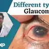 Glaucoma Types, Risks, and Importance of Regular Eye Check-ups, watch video