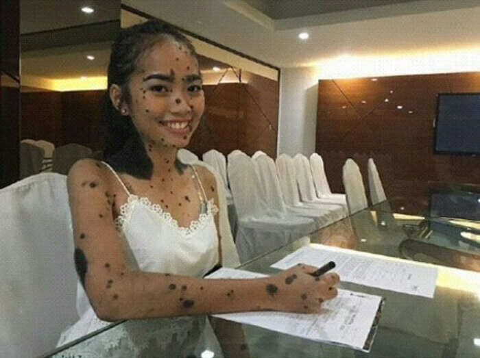 Moles Girl Miss Universe