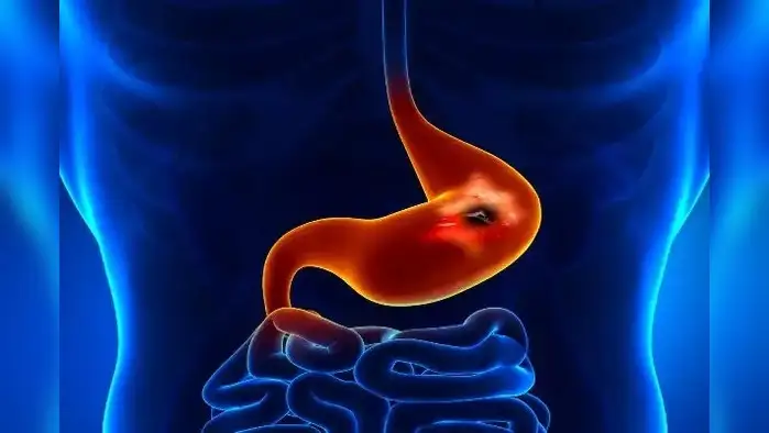 Kalarchikai Benefits,ஆண்களுக்கு விதைப்பை வலி, வீக்கத்தை சரிசெய்ய உதவும் ...