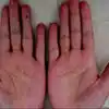 palmistry if both hands makes a half moon shape then it is good for ...