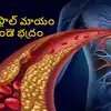 అల్లం ఎలా వాడాలి,ఓ చిన్న అల్లం ముక్క ఉంటే చాలు సిరల్లో పేరుకుపోయిన ...