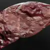 How To Differentiate Enlarged Liver And Bloating Explains By ...