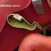 Gallbladder Cancer : ஆரம்ப அறிகுறியை சொல்லாமல் கொல்லும் பித்தப்பை ...