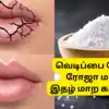 Natural Scrubs For Chapped Lips Natural Scrubs For Chapped Lips,Sea ...