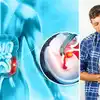 malakudal putrunoi symptoms : 35–45 வயதினரிடம் அதிகரிக்கும் மலக்குடல் ...