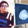 Raththa Putrunoi Treatment,எலும்பு மஜ்ஜை மாற்று சிகிச்சைனா என்ன? ரிஷி ...