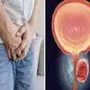 Prostate Pain : வண்டி ஓட்டும்போது விதைப்பை வலிக்குதா? அந்த வலிக்கு இந்த ...