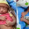 Telangana 24 Fingers Baby,தெலுங்கானாவில் 24 விரல்களோடு பிறந்த தெய்வ ...