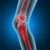 Knee Pain Causes,ನೀವು ಯಾವತ್ತಾದ್ರೂ ದೇಹದ ಮೂಳೆ ಮುರಿದ ರೀತಿ ಶಬ್ಧ ಆಗೋದನ್ನು ...